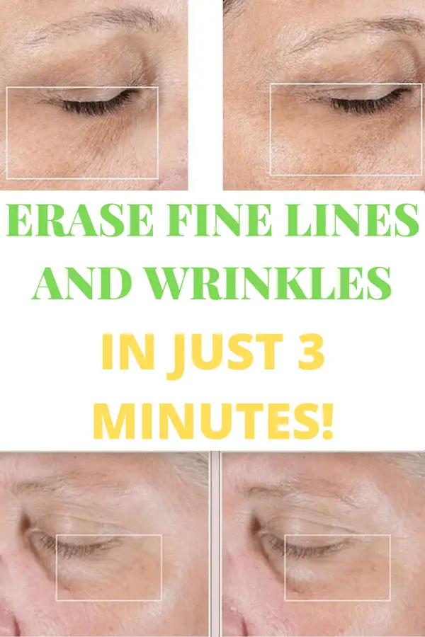 NuFACE FIX Line Smoothing Device Review NuFACE FIX Line Smoothing Device Review